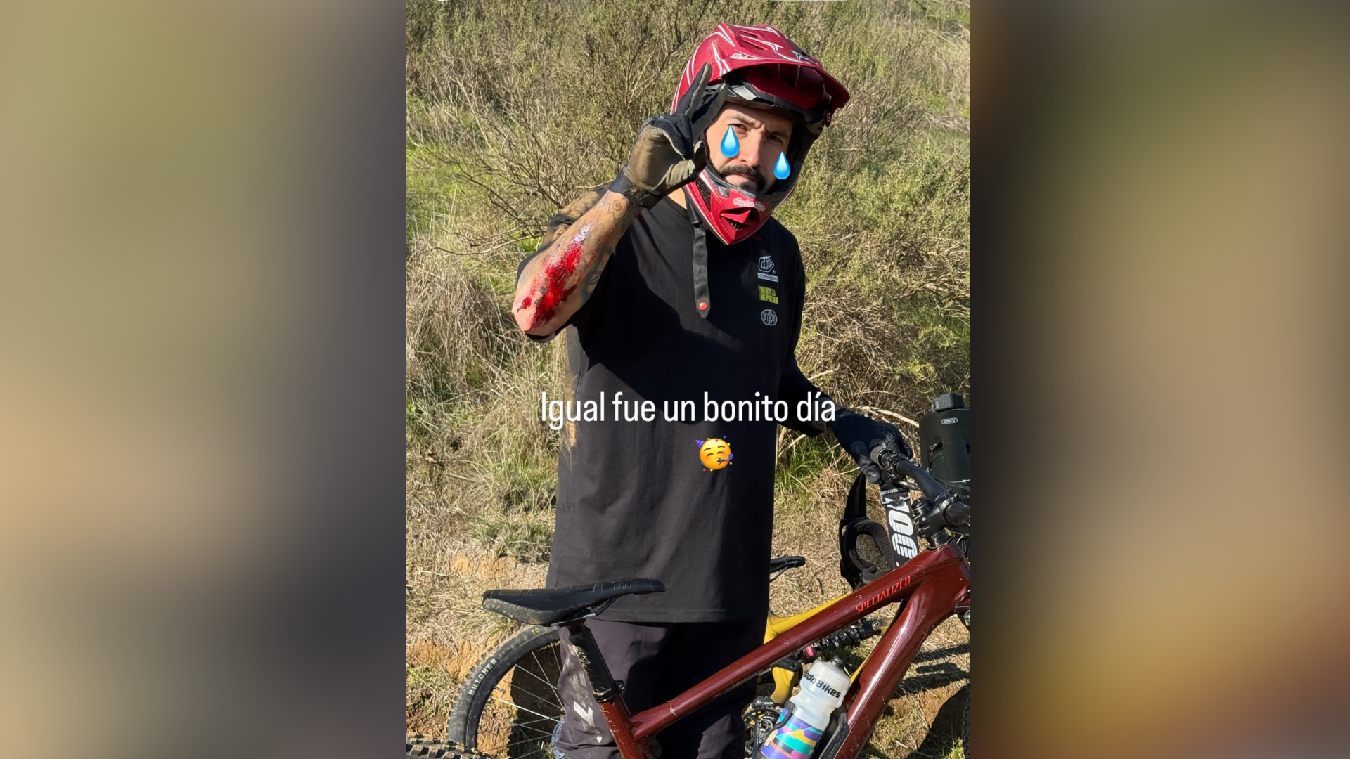 Edo Caroe sufrió fuerte caída mientras practicaba ciclismo: “Mucho ...